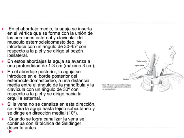 Técnica de colocación de catéter venoso central | PPTX