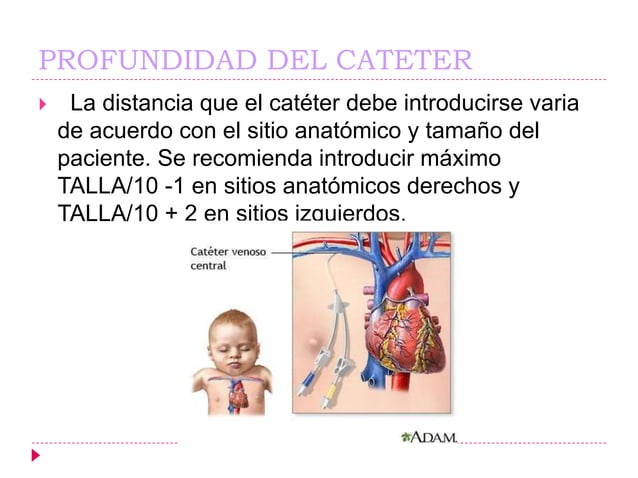 Técnica de colocación de catéter venoso central | PPTX