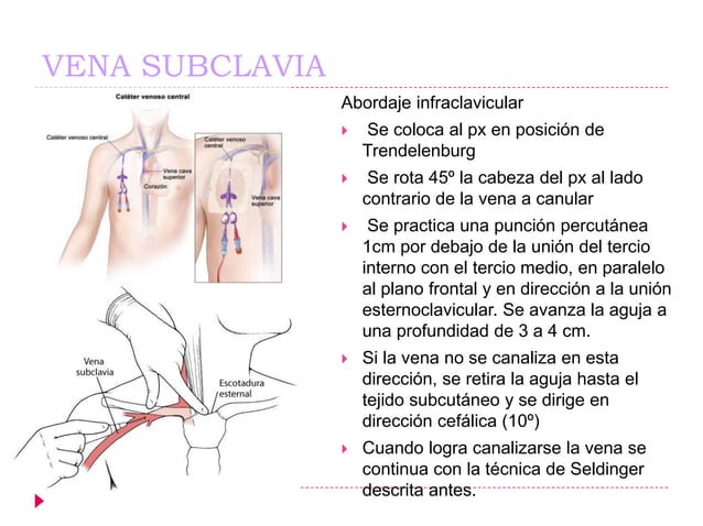 Técnica de colocación de catéter venoso central