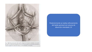 TECNICA DE COLPOPERINEOPLASITA.pptx