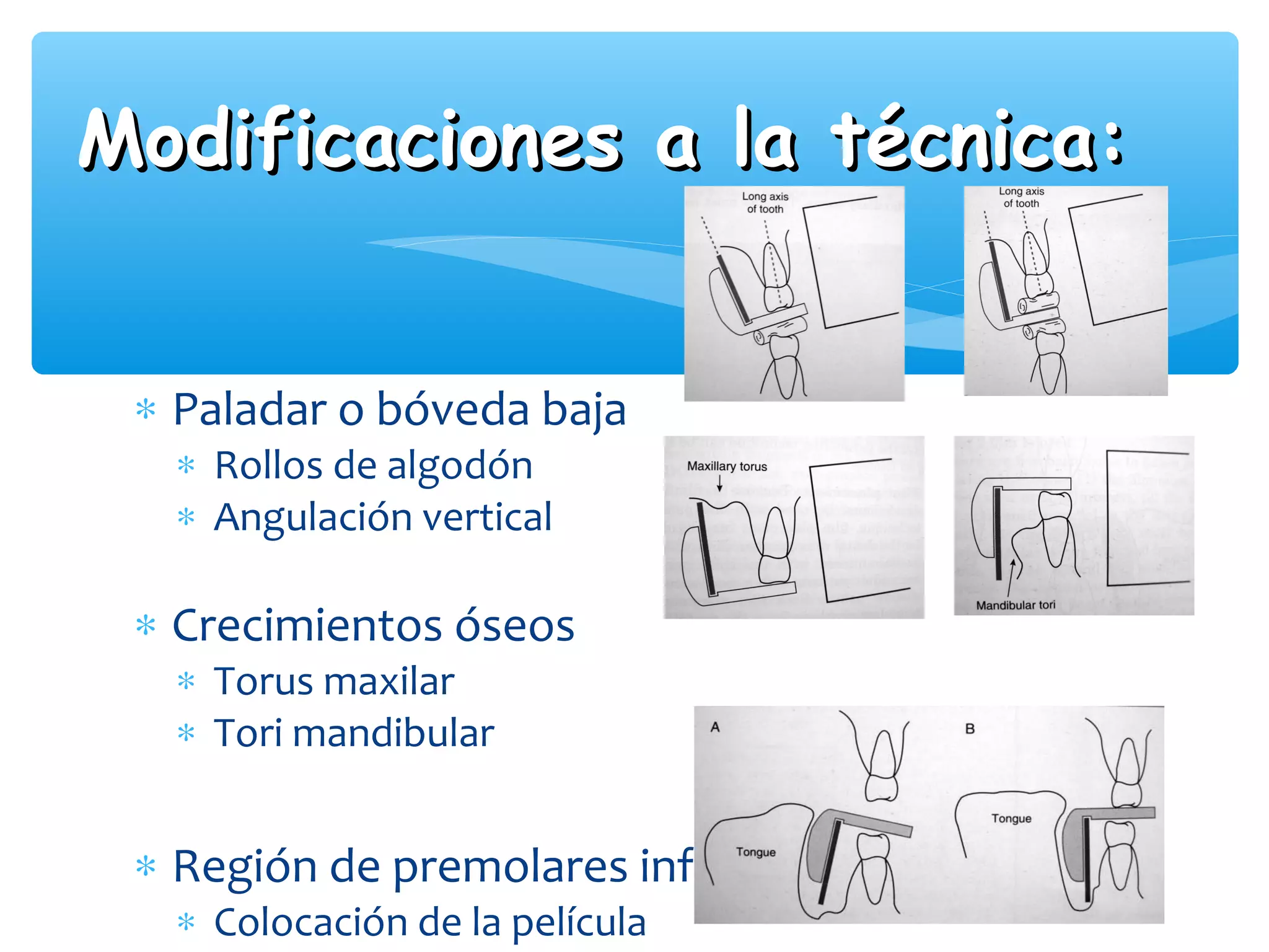 Radiologia Tecnica de paralelismo | PPT