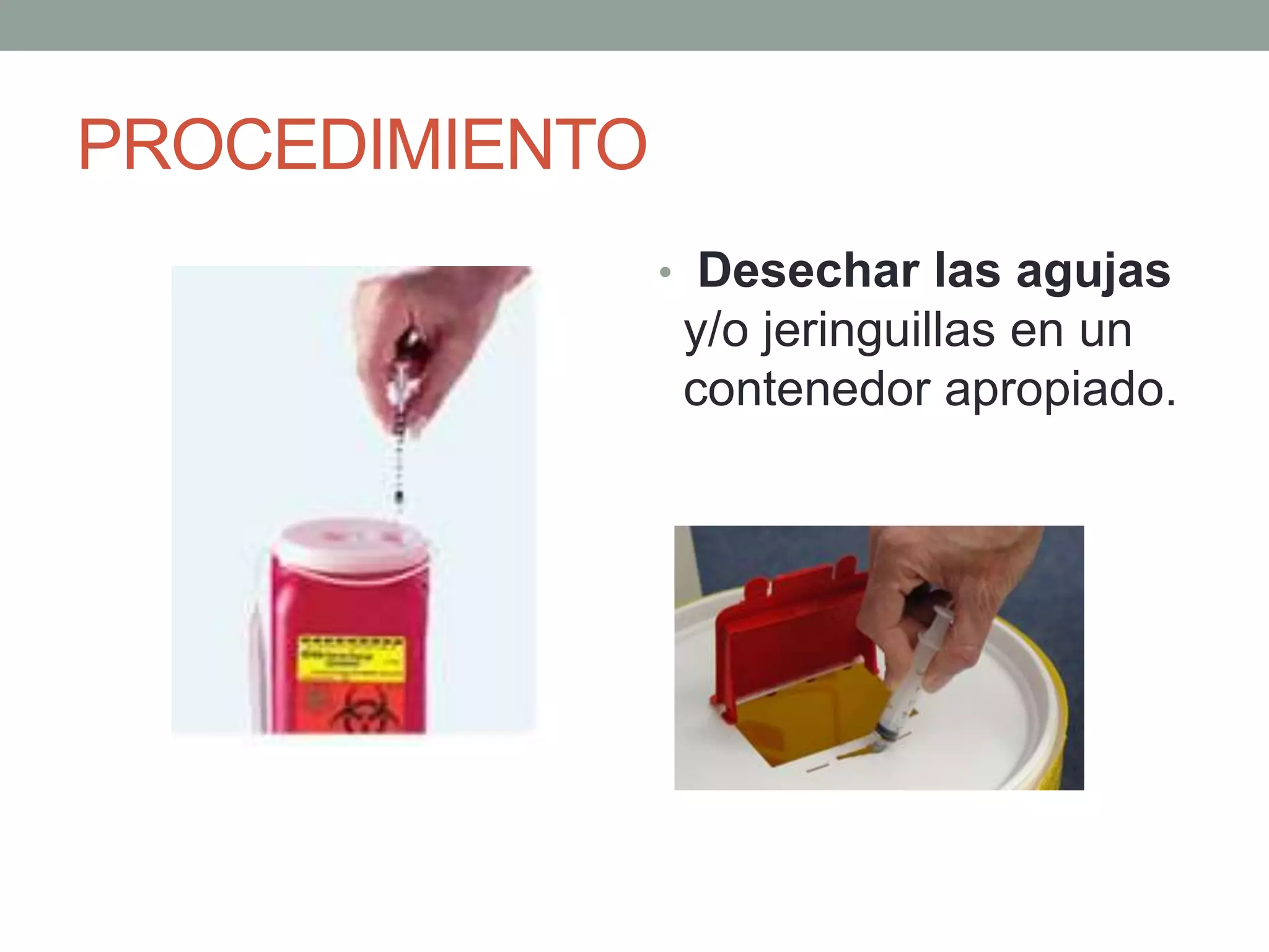 Técnica de punción venosa | PPTX