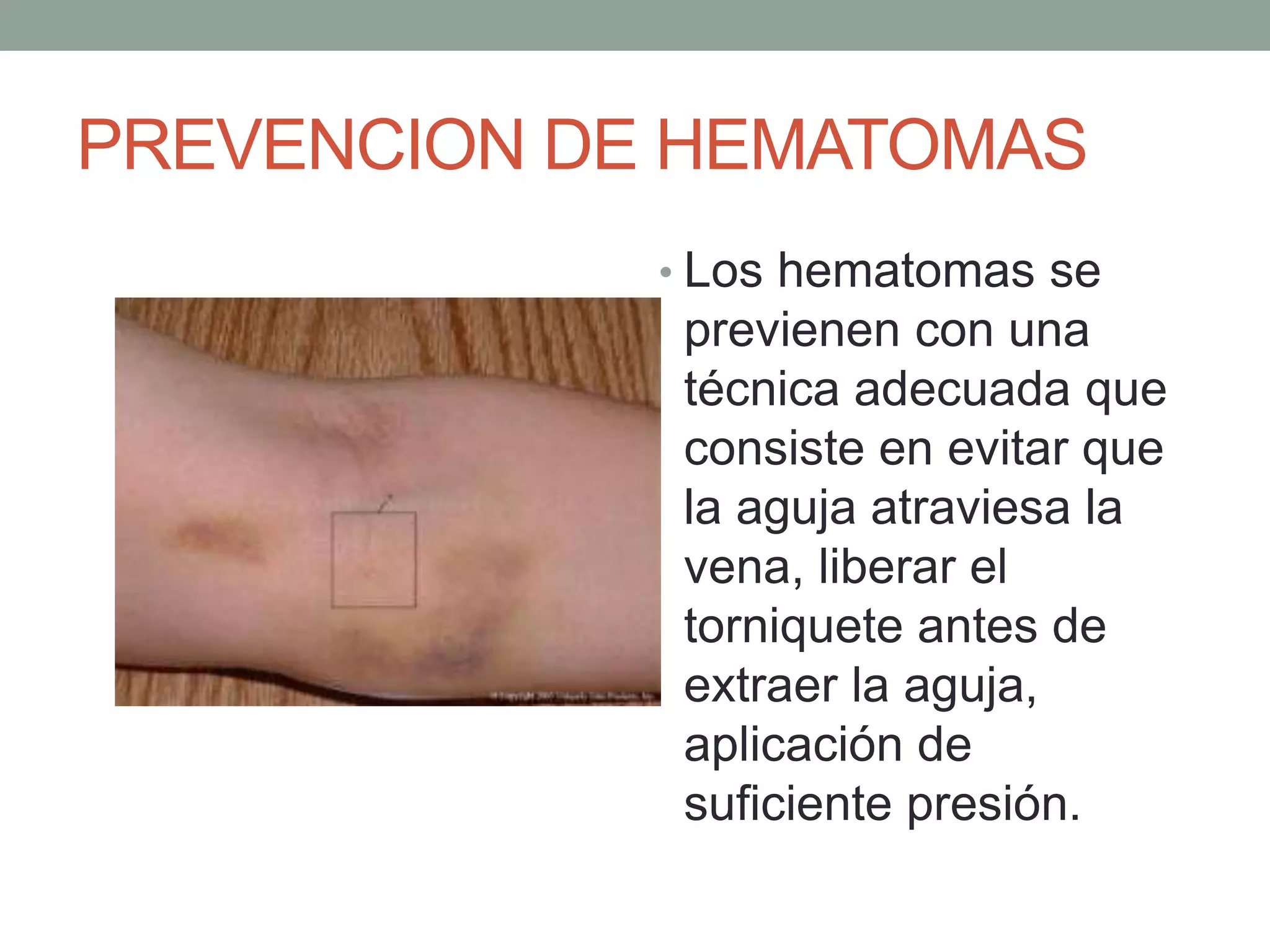 Técnica de punción venosa | PPTX