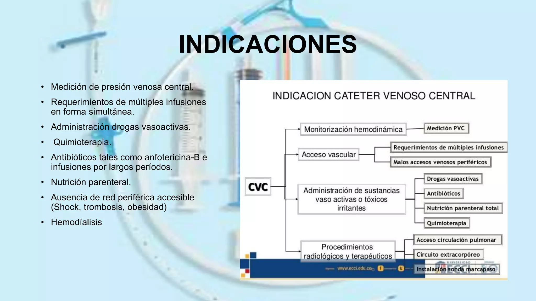 Tecnica de seldinger | PPTX