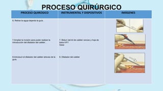 Tecnica de seldinger | PPTX
