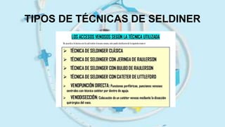 Tecnica de seldinger | PPTX