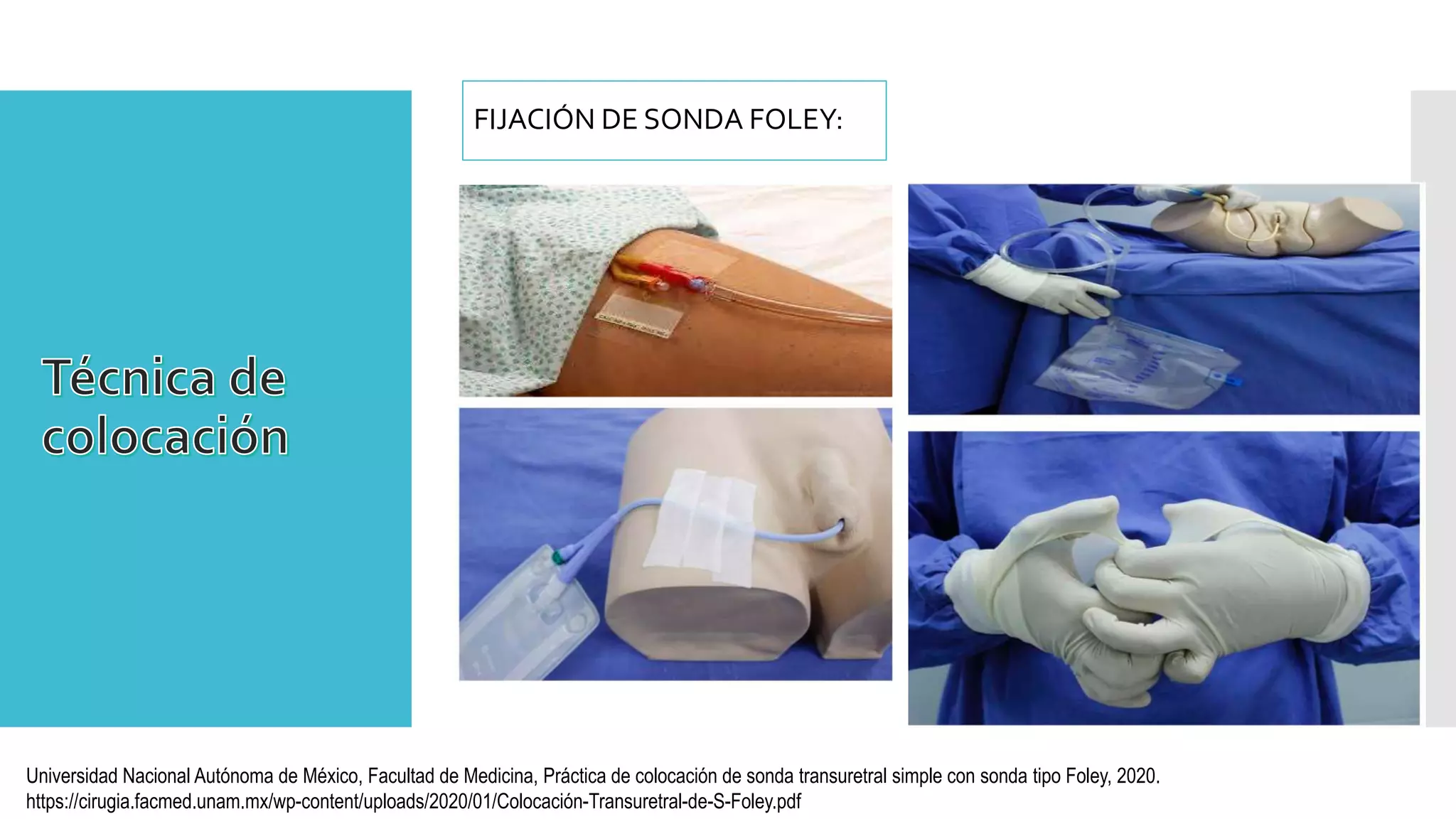 Técnica de sondaje vesical.pptx