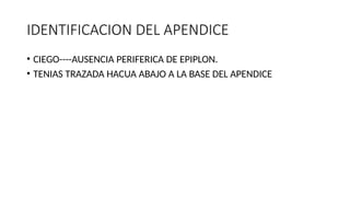 TECNICA QUIRURGICA APENDICECTOMIA.pptx