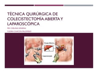 TECNICA QUIRURGICA DE COLECISTECTOMIA.pptx