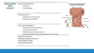 Técnica Qx Colecistectomía.pptx