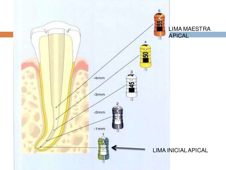 Tecnicas apico y corono apicales