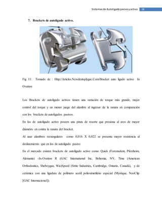 Tecnicas de autoligado | DOCX
