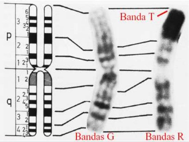 Tecnicas de Bandeo Cromosomico