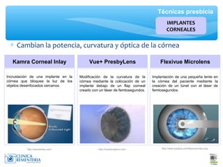 Tecnicas de correccion de de la presbicia | PPT