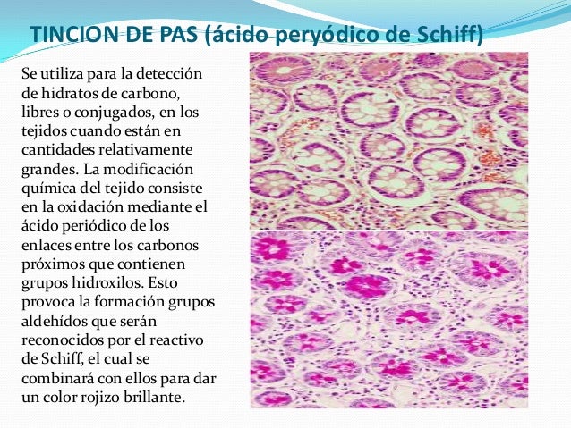 Tecnicas de histoquimica