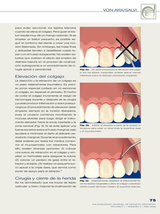 tecnicas de incision y colgajos.pdf