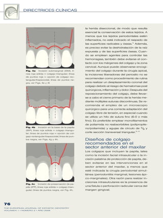 tecnicas de incision y colgajos.pdf