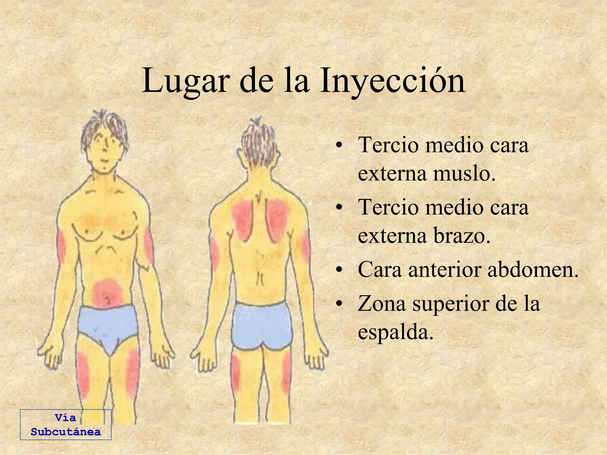 TECNICAS DE INYECCION PARENTERAL .ppt
