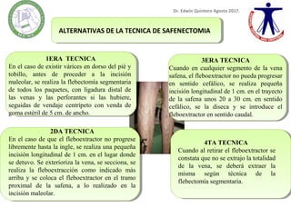 Tecnicas de safenectomia | PPT