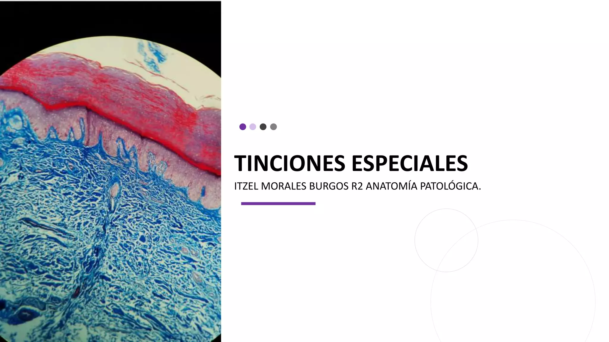 TECNICAS ESPECIALES.pptx