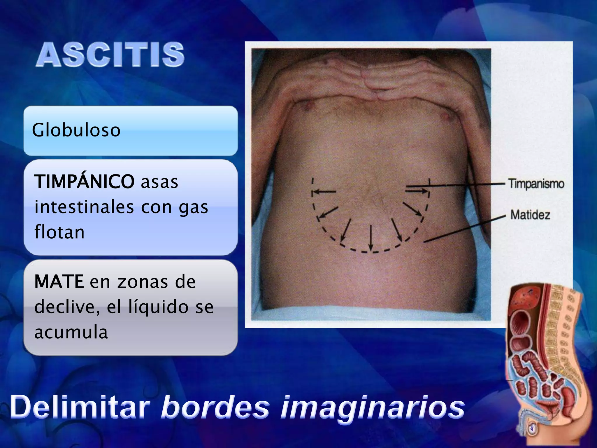 Técnicas Especiales de Exploracion Abdominal | PPTX