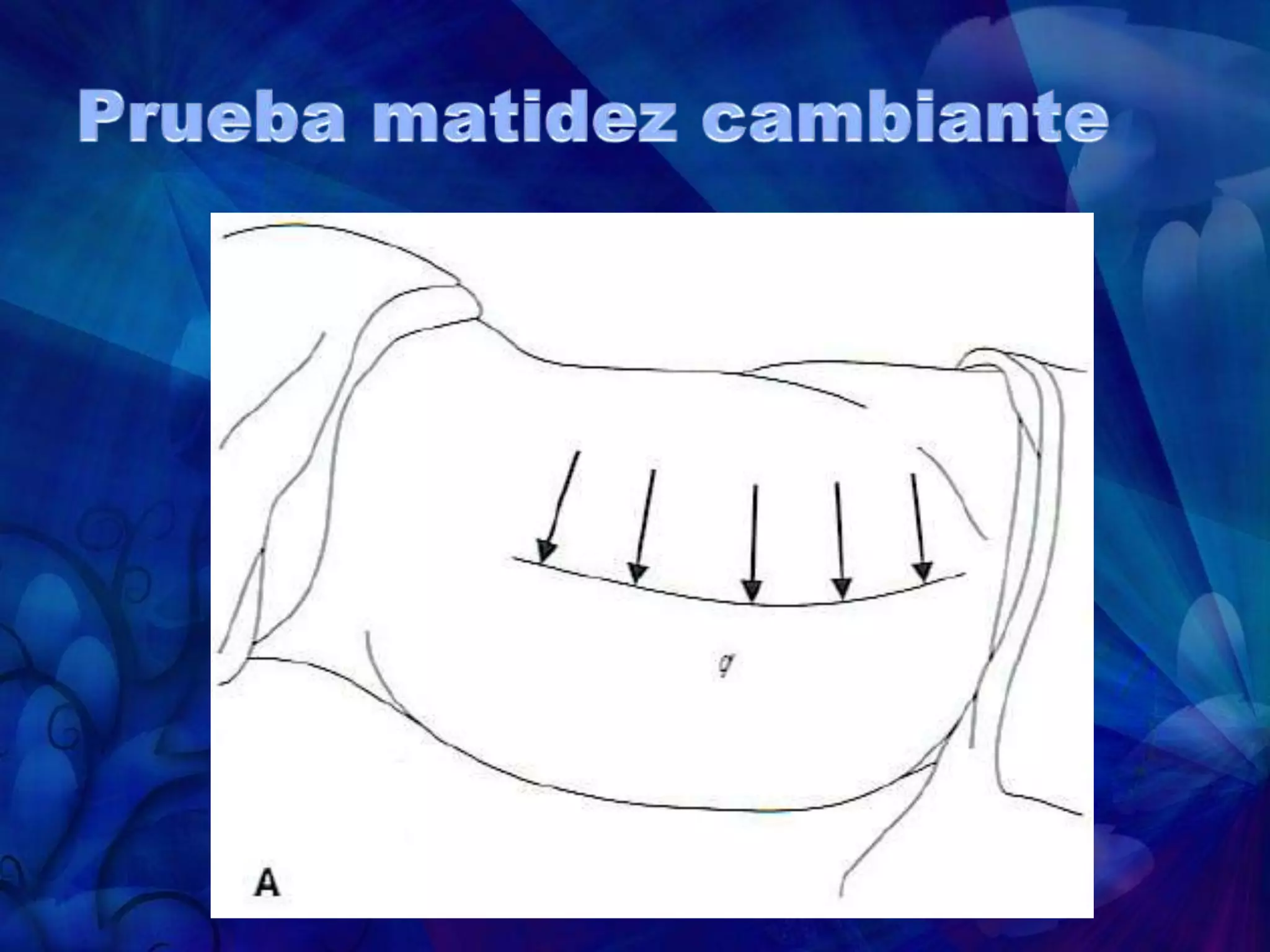 Técnicas Especiales de Exploracion Abdominal | PPTX