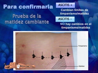 Técnicas Especiales de Exploracion Abdominal | PPTX