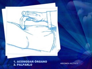 Técnicas Especiales de Exploracion Abdominal | PPTX