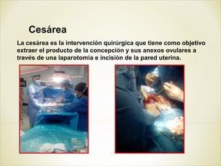 Tecnicas Quirurgica De Gineco 2 Ppt