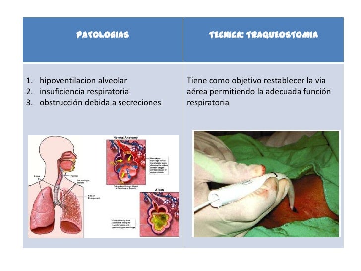 Tecnicas Y Patologias Quirurgicas En Cirugia General