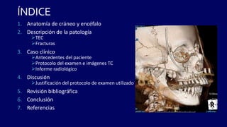 TEC TC | PPTX