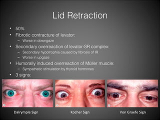 Thyroide Eye Disease | PPT