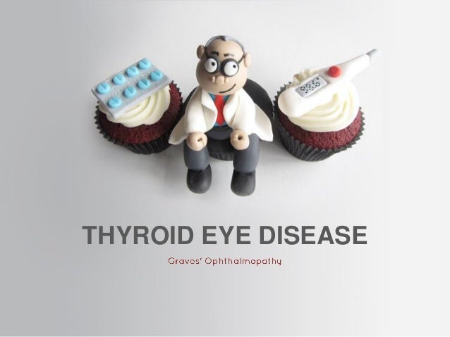 Thyroid Eye Disease Ted
