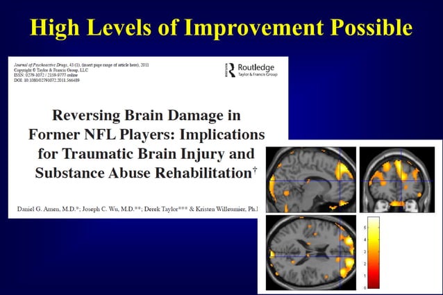 Tedx lesson from 83,000 scans | PPT