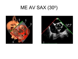 Trans esophageal echocardiography (TEE) orientation | PPT | Heart and ...
