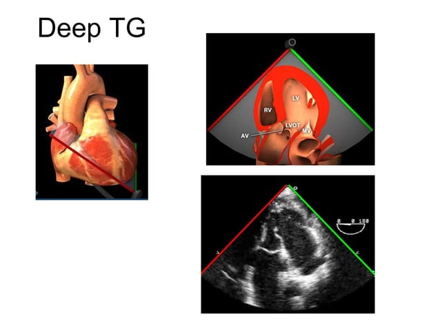 Trans esophageal echocardiography (TEE) orientation | PPT | Heart and ...