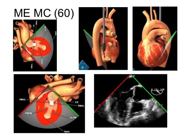 Trans esophageal echocardiography (TEE) orientation