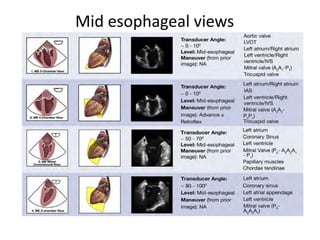 Transesophageal Echocardiography(TEE) | PPTX