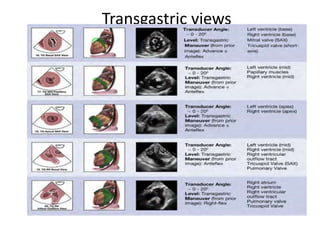 Transesophageal Echocardiography(TEE) | PPTX