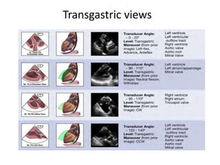 Transesophageal Echocardiography(TEE) | PPTX