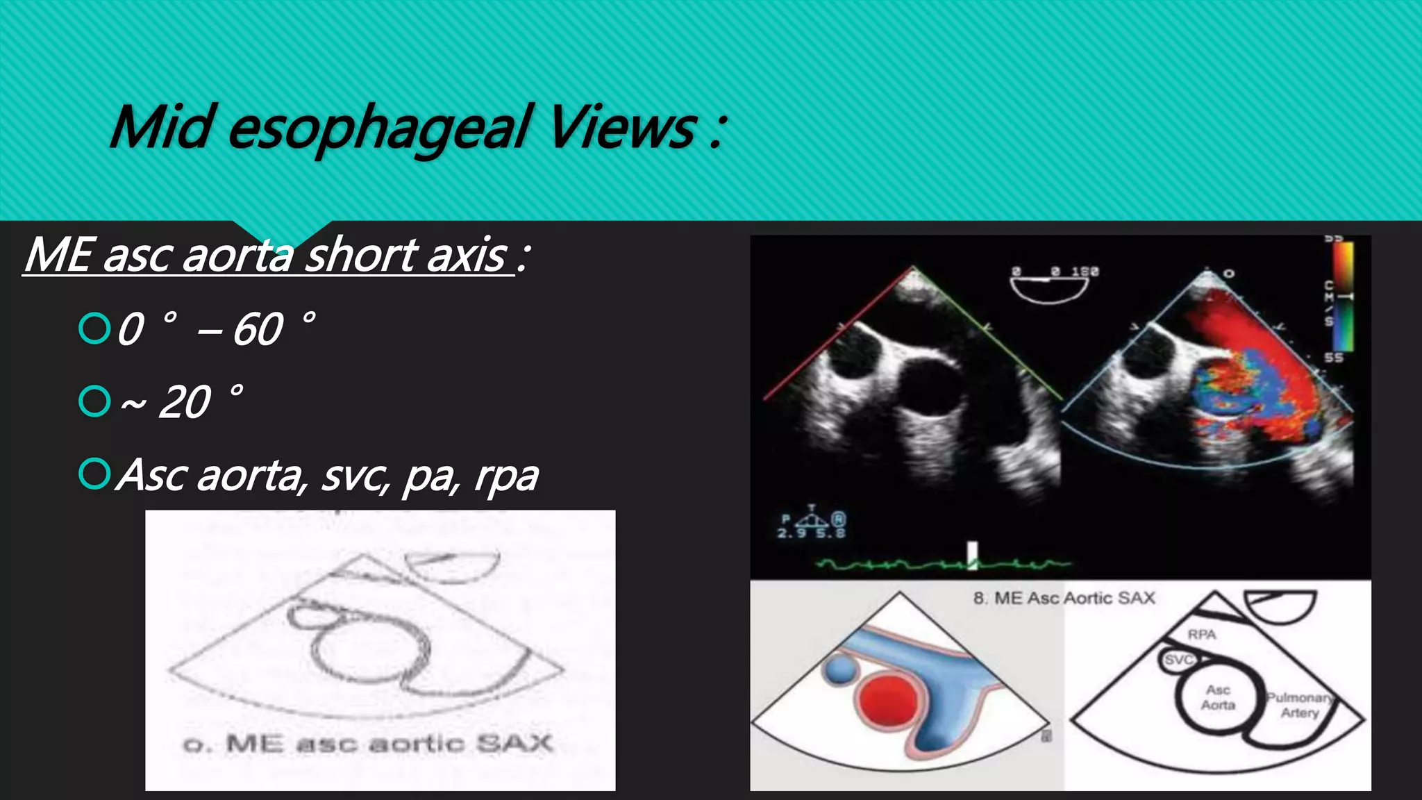 TRANSESOPHAGEAL ECHOCARDIOGRAPHY | PPTX