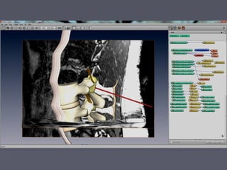 Possibilities of application of 3D-PDF documents to represent models ...