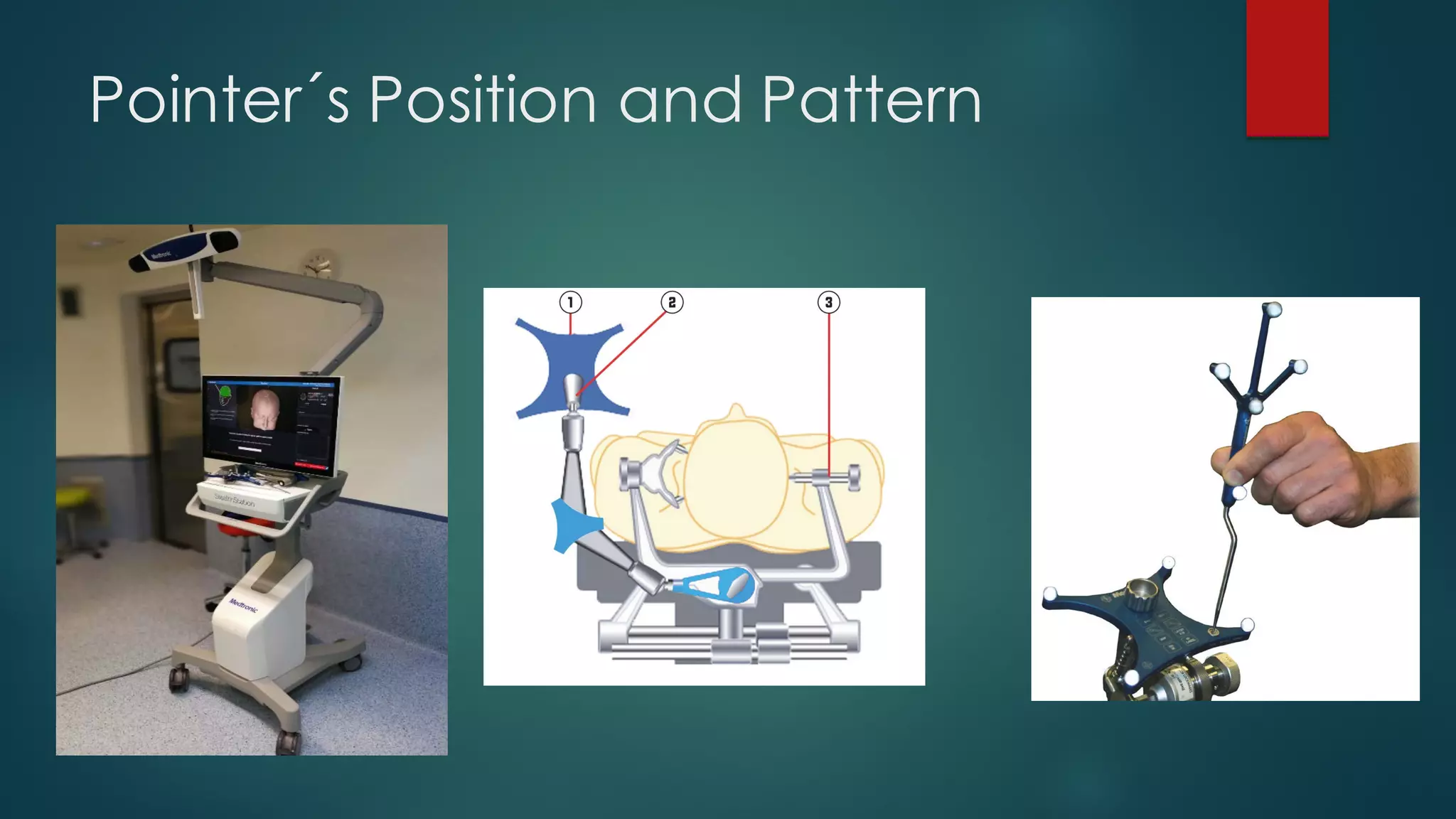 Neuronavigation Software to visualize and surgically approach brain ...