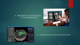 Neuronavigation Software to visualize and surgically approach brain ...