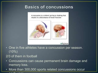 Teens and sport related concussions | PPTX