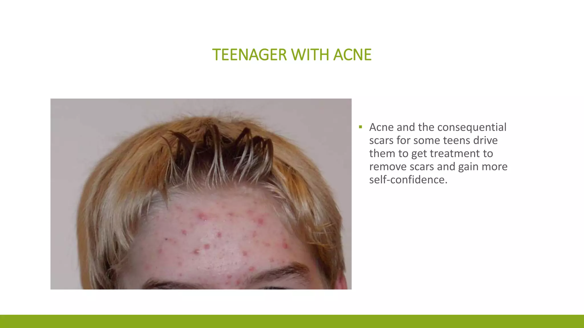 Teens & Cosmetic Surgery | PPT