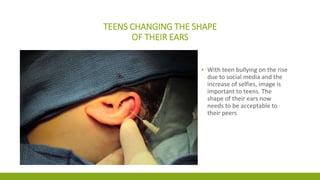 Teens & Cosmetic Surgery | PPTX