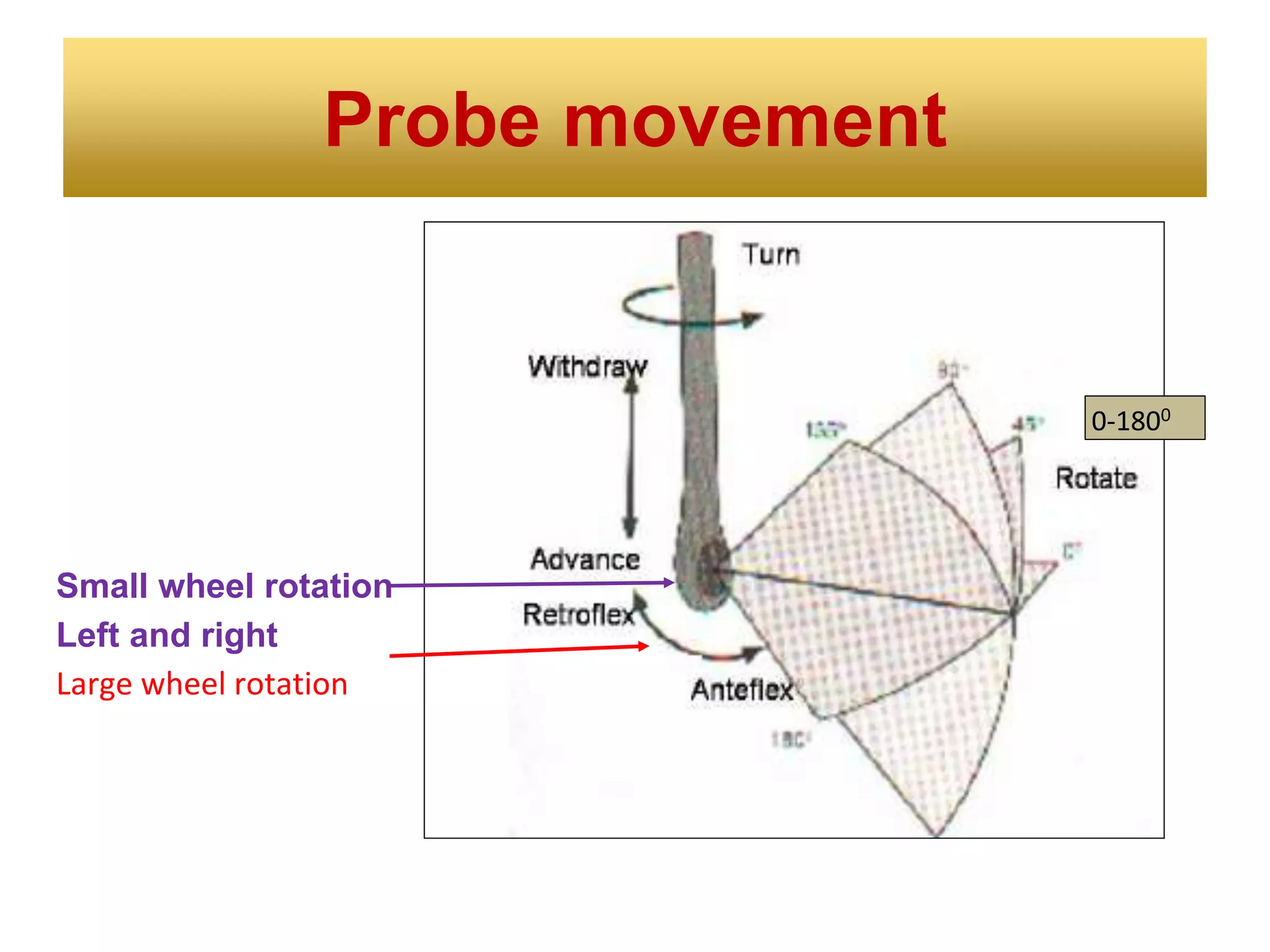 comprehensive TEE examination | PPTX