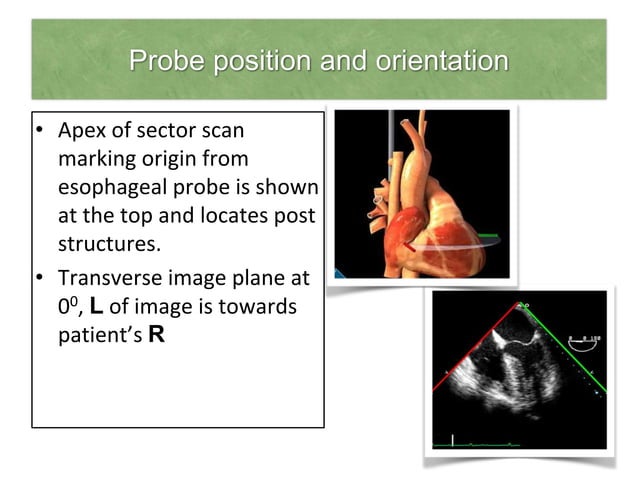 comprehensive TEE examination | PPT