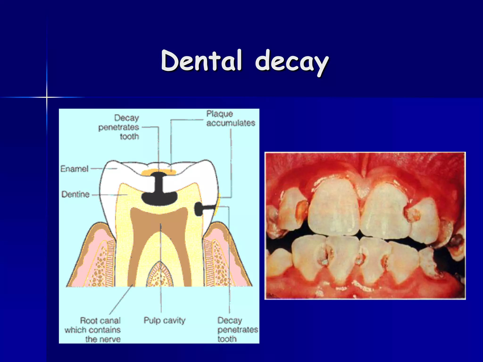 Teeth | PPT